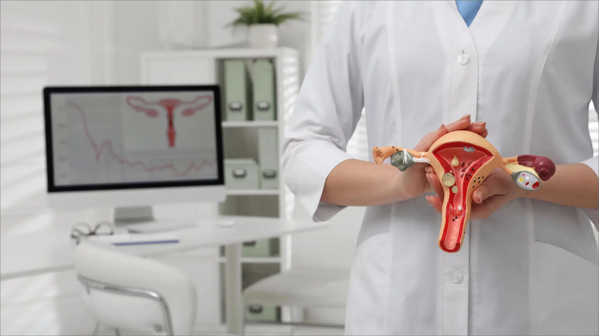 VPH en mujeres; qué es y cómo se detecta | Chopo