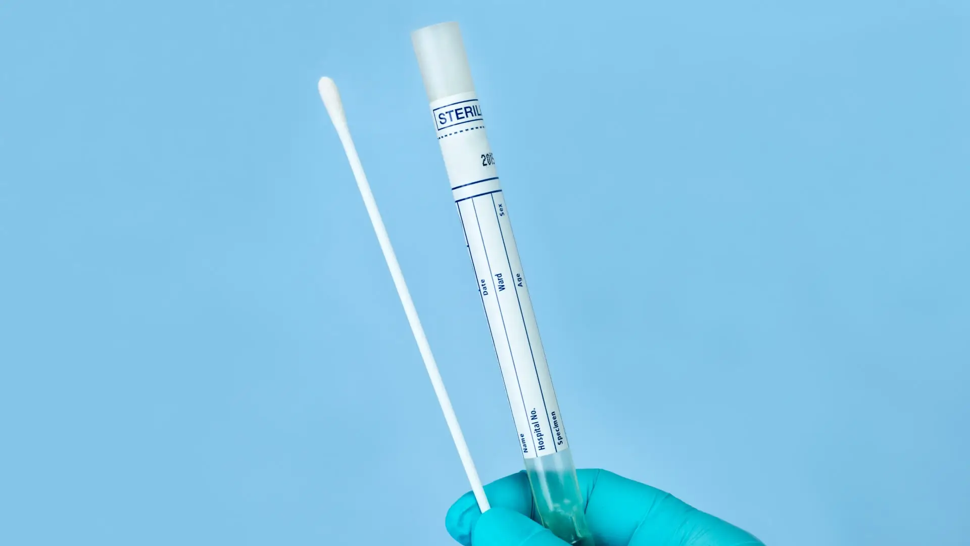 Exudado faríngeo | Cultivo y antibiograma