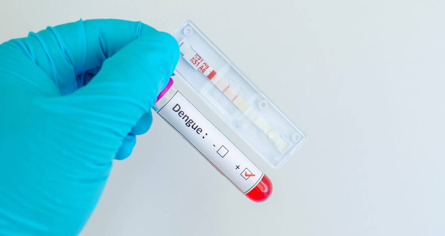 Dengue | Tipos y diagnóstico