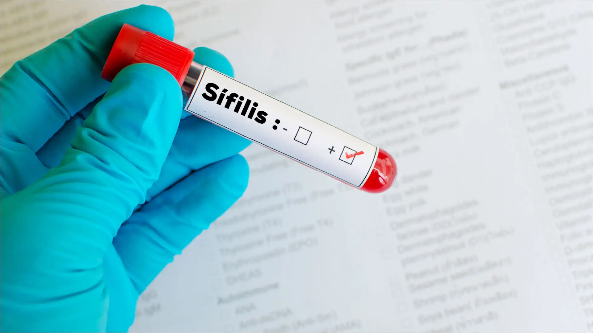 ¿Qué es la sífilis y cómo se detecta? | Chopo